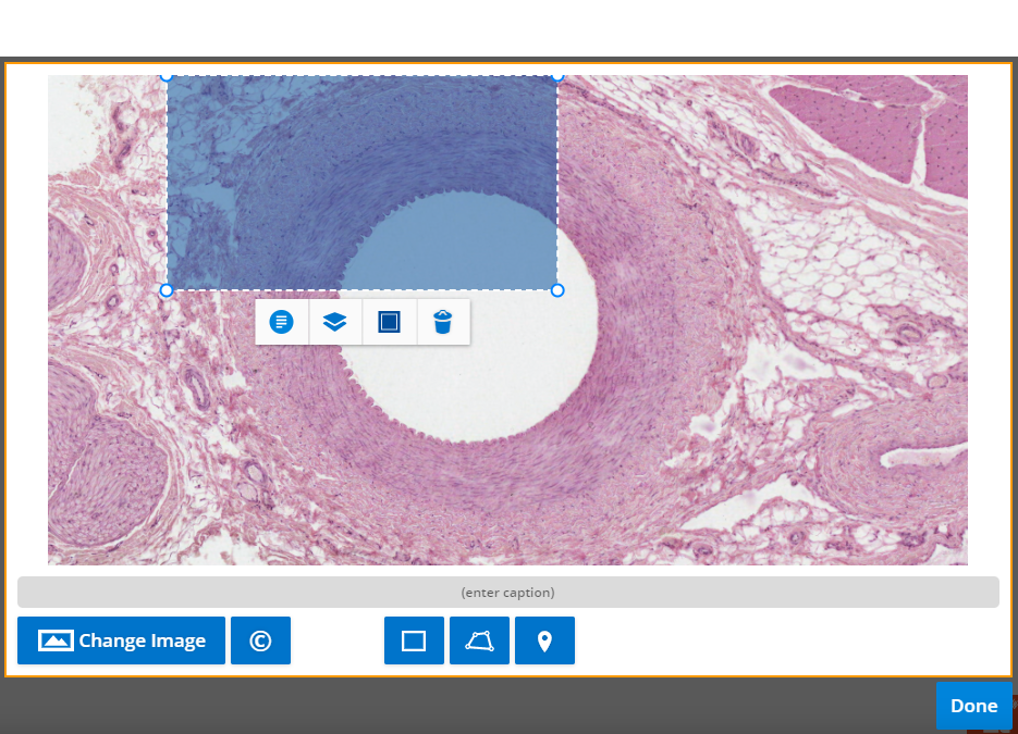 Creating Lt Hotspot Panels | ADInstruments